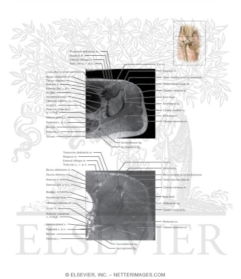 Cross Section of the Hip: Axial View