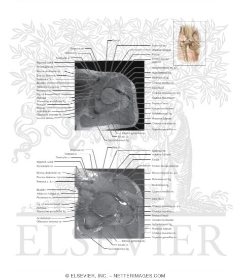 Cross Section of the Hip: Axial View
