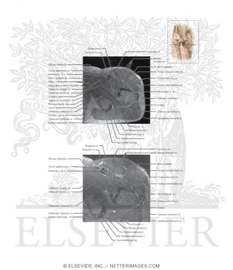 Cross Section of the Hip: Axial View