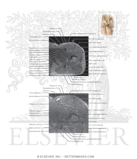 Cross Section of the Hip: Axial View