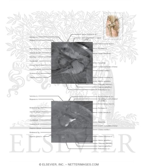 Cross Section of the Hip: Axial Oblique View