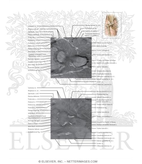 Cross Section of the Hip: Axial Oblique View