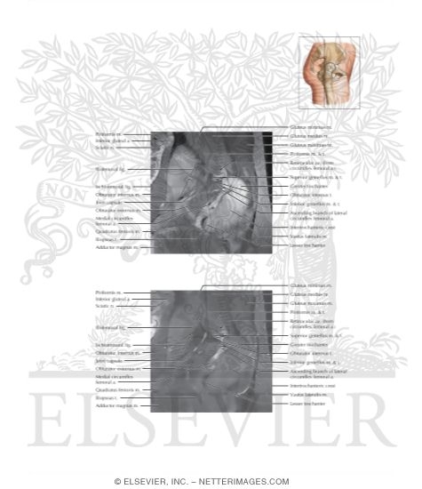 Cross Section of the Hip: Coronal View