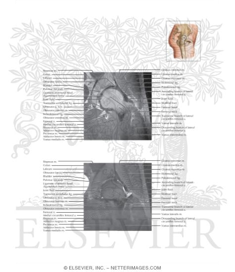 Cross Section of the Hip: Coronal View