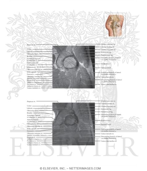 Cross Section of the Hip: Coronal View