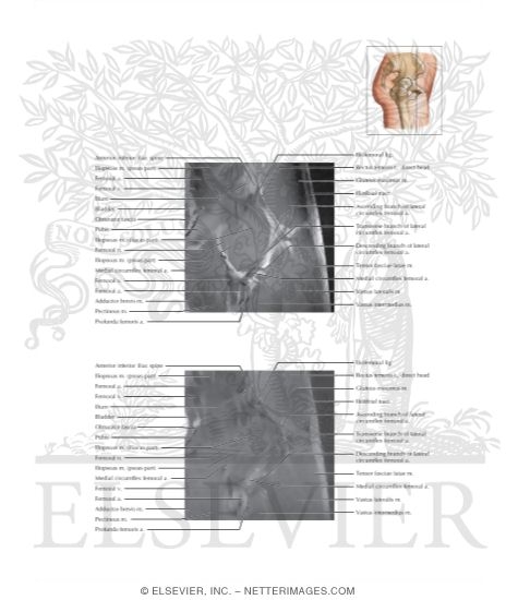 Cross Section of the Hip: Coronal View
