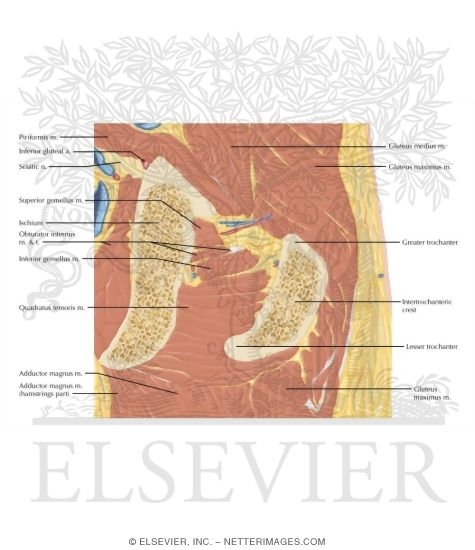 Cross Section of the Hip: Coronal View