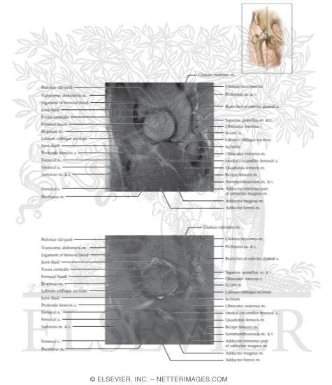 Cross Section of the Hip: Sagittal View