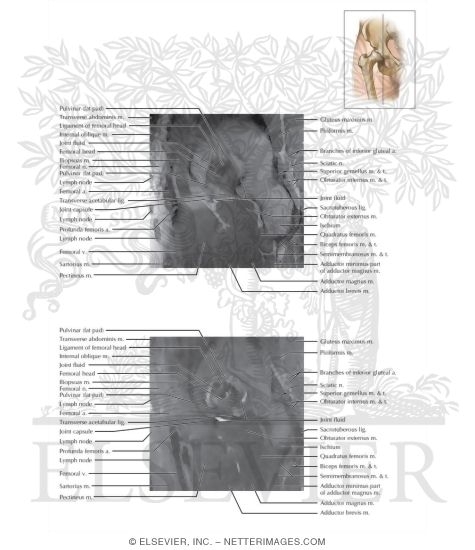Cross Section of the Hip: Sagittal View