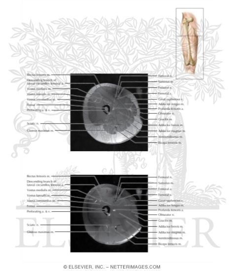 Cross Section of the Thigh: Axial View
