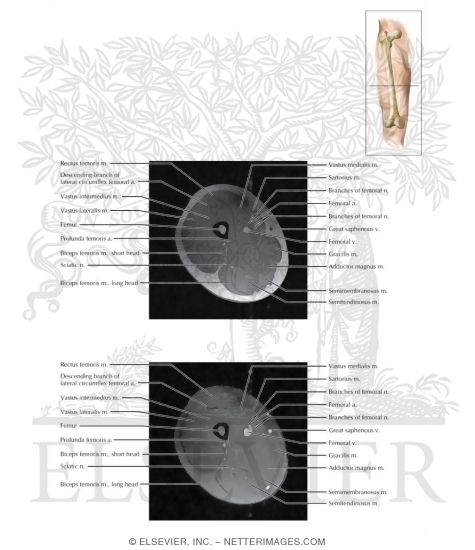Left Thigh Cross Section