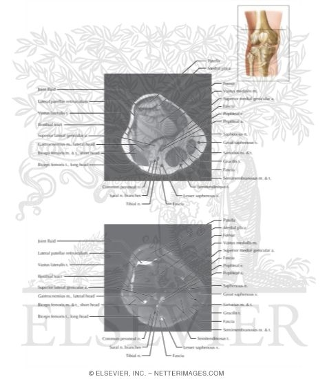 Cross Section of the Knee: Axial View