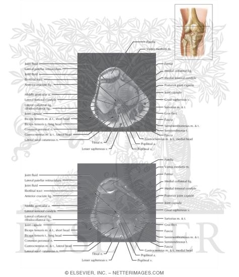Cross Section of the Knee: Axial View