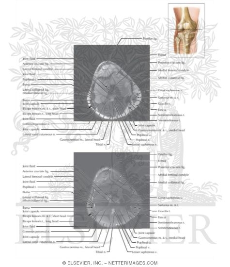 Cross Section of the Knee: Axial View