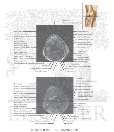 Cross Section of the Knee: Axial View