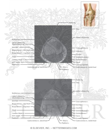 Cross Section of the Knee: Axial View