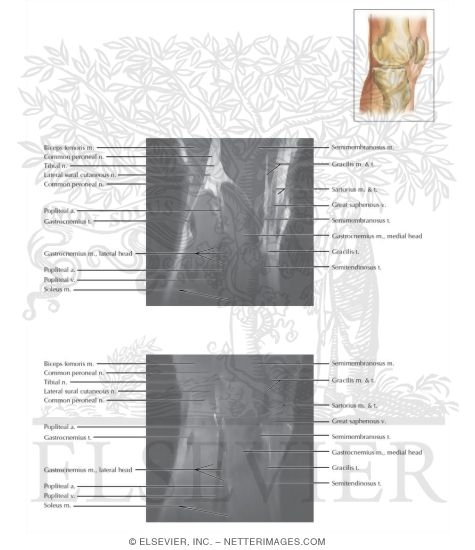 Cross Section of the Knee: Coronal View