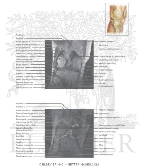Cross Section of the Knee: Coronal View