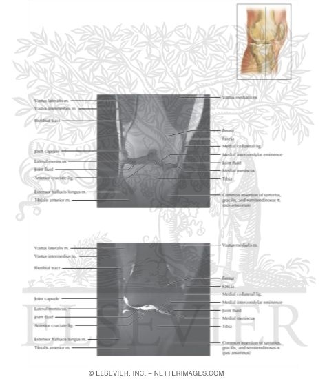 Cross Section of the Knee: Coronal View