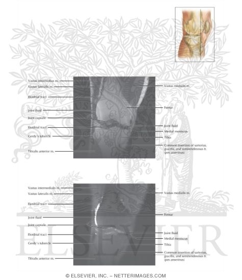 Cross Section of the Knee: Coronal View