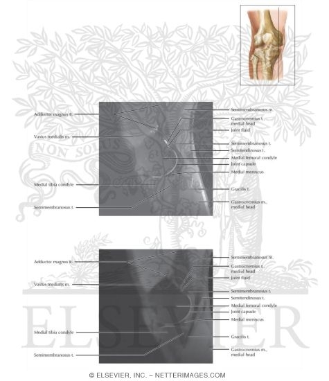 Cross Section of the Knee: Sagittal View