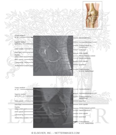 Cross Section of the Knee: Sagittal View