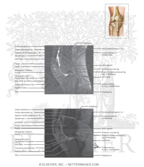 Cross Section of the Knee: Sagittal View