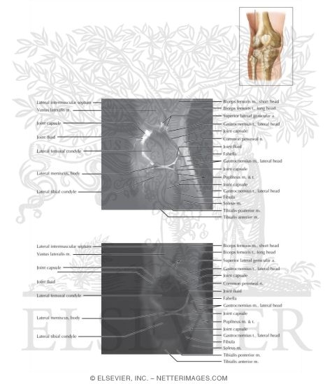 Cross Section of the Knee: Sagittal View
