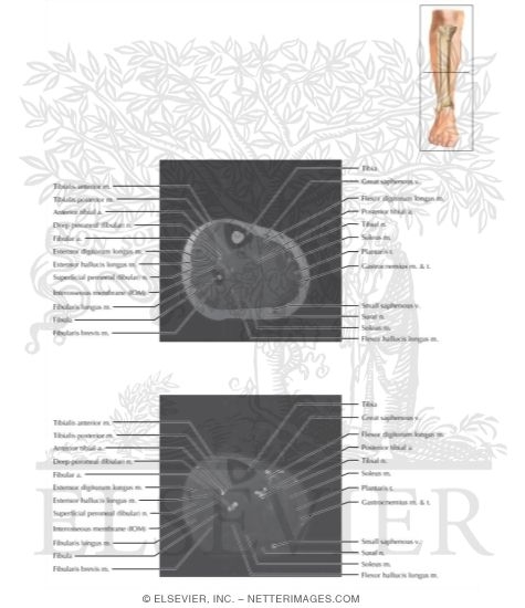 Cross Section of the Lower Leg: Axial View