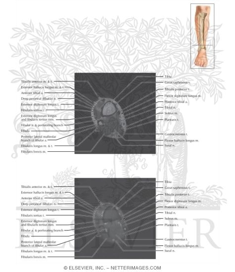 Cross Section of the Lower Leg: Axial View