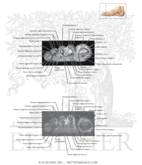 Cross Section of the Ankle and Foot: Coronal View