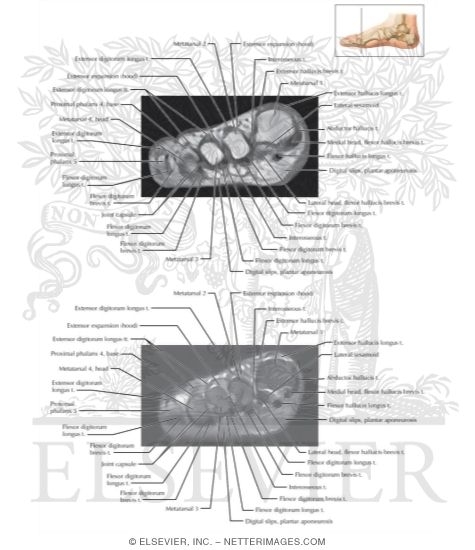 Cross Section of the Ankle and Foot: Coronal View