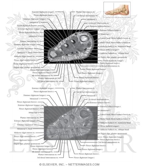 Cross Section of the Ankle and Foot: Coronal View