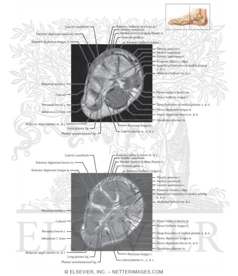 Cross Section of the Ankle and Foot: Coronal View