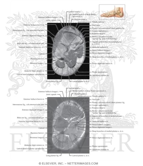 Cross Section of the Ankle and Foot: Coronal View