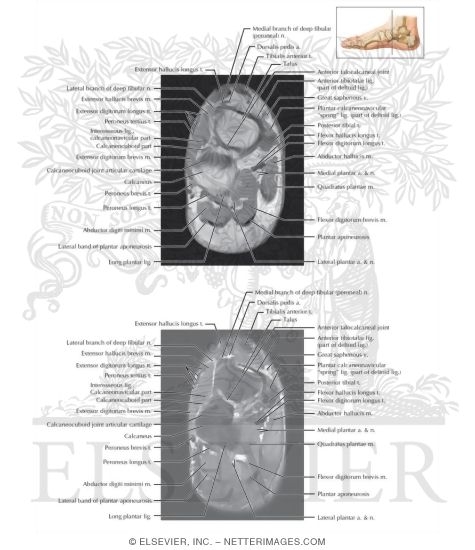 Cross Section of the Ankle and Foot: Coronal View