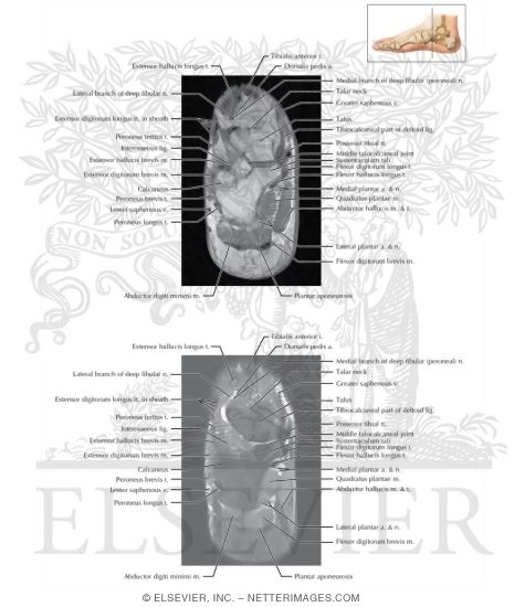 Cross Section of the Ankle and Foot: Coronal View