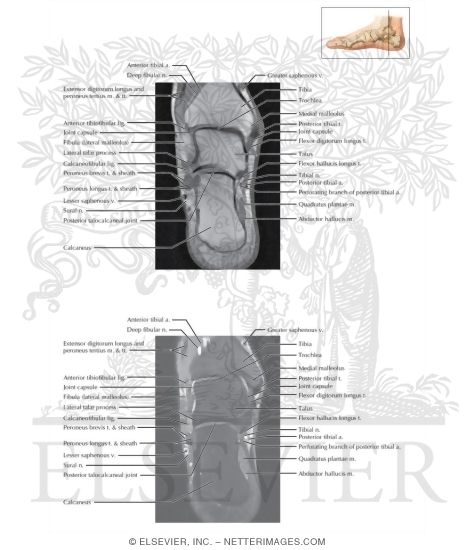 Cross Section of the Ankle and Foot: Coronal View
