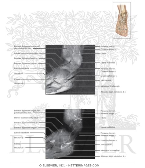 Cross Section of the Ankle and Foot: Coronal View