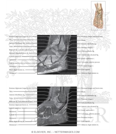 Cross Section of the Ankle and Foot: Coronal View