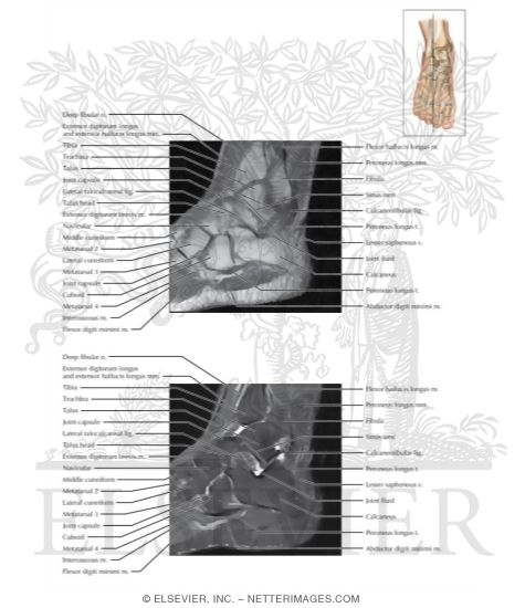 Cross Section of the Ankle and Foot: Coronal View