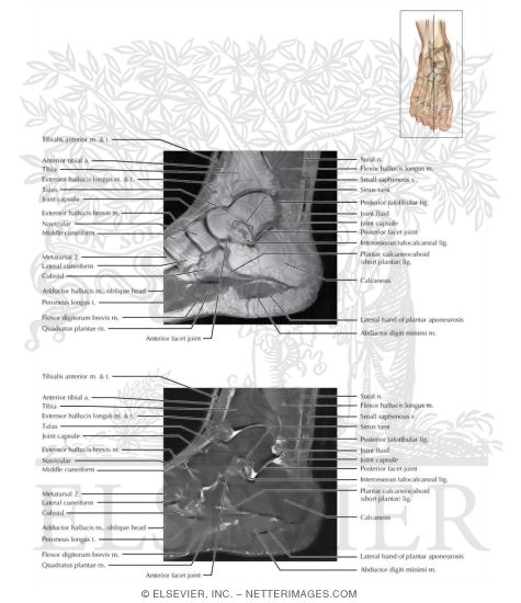 Cross Section of the Ankle and Foot: Coronal View