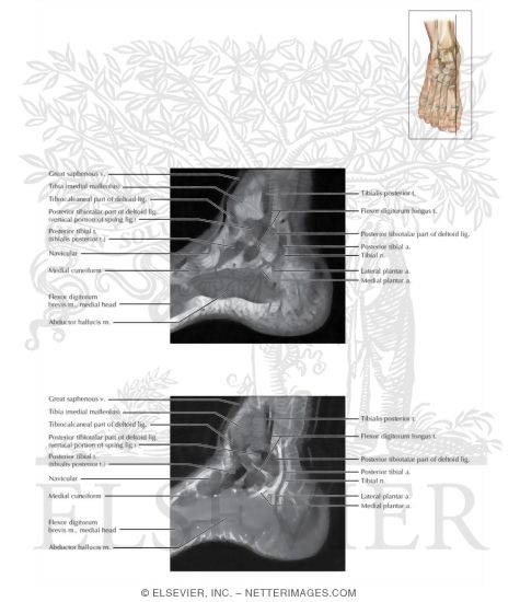 Cross Section of the Ankle and Foot: Coronal View