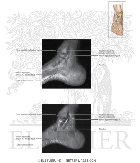 Cross Section of the Ankle and Foot: Coronal View