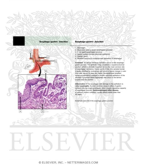 Light Micrograph of the Esophagogastric Junction