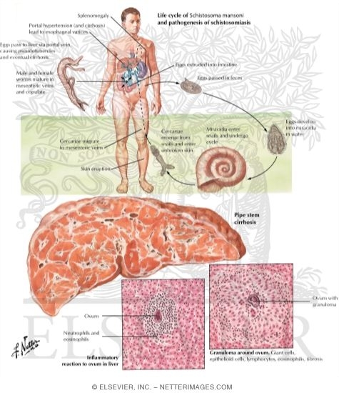 Welcome To Netter Images