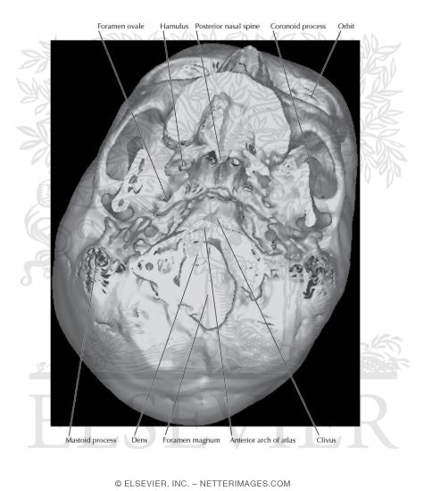 3D CT Scan of Skull Base