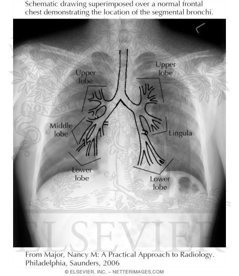 Radiograph of Bronchii