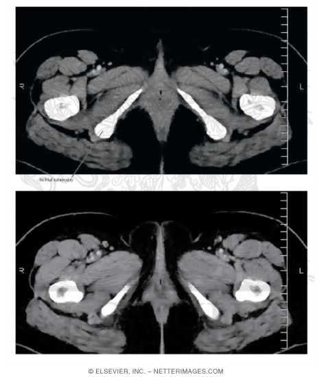 Radiographs: Female Pelvis