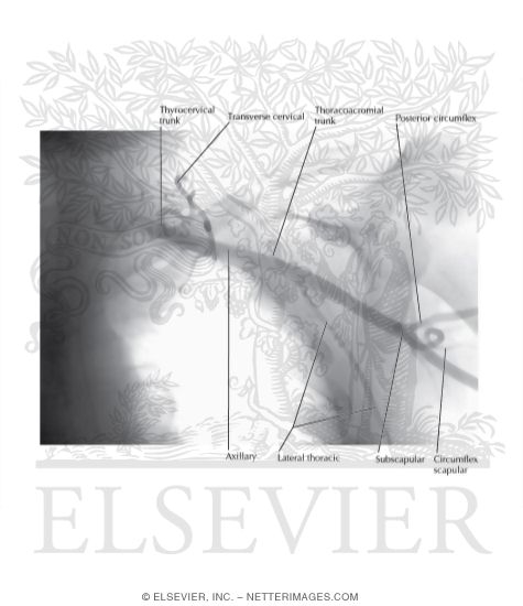 Axillary Arteriogram